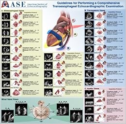 Guidelines for Performing a Comprehensive Transesophageal Echocardiogram: The American Society ...