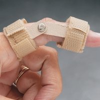 Buy Norco(tm) Lateral Pip Hinge Splint, Small Ideal for Limiting Radial ...