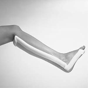 Amazon.com: 3M Scotchcast One Step Splint 76430 4" x 30": Health ...