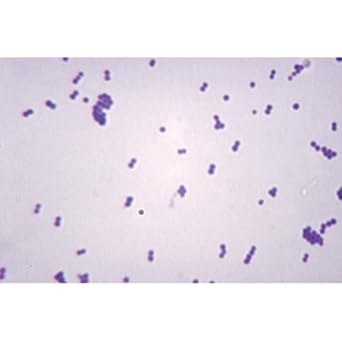 Amazon.com: Staphylococcus aureus w.m. Microscope Slide: Industrial ...