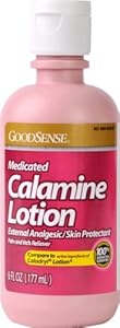 Amazon.com: Good Sense Medicated Calamine Lotion -- 6 fl oz: Health ...