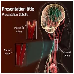Amazon.com: Stroke PowerPoint Template - Stroke PowerPoint (PPT ...