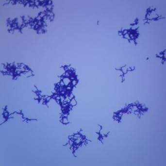 Amazon.com: Streptococcus pyogenes, w.m. Microscope Slide: Industrial ...