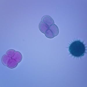 Pollen Microscope Slides