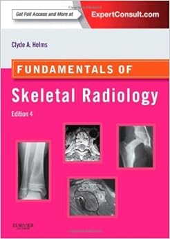 Fundamentals Of Skeletal Radiology Clyde A. Helms Free - The best free ...