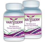 How To Get Rid Of Spider Veins For Gorgeous Legs - Best All Natural ...