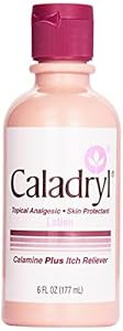 Amazon.com: Caladryl Lotion, Calamine Plus Itch Reliever, 6-Ounce ...