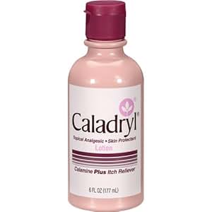 Amazon.com : Caladryl Caladryl Lotion Calamine Plus Itch Reliever 6 Fl ...