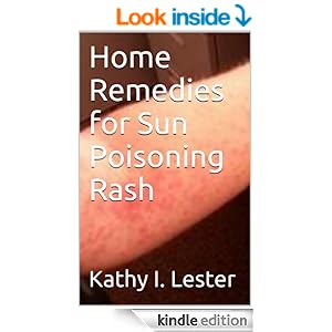 Home Remedies for Sun Poisoning Rash - Kindle edition by Kathy I ...