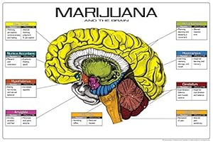 Amazon.com: Marijuana and the Brain 24" X 36" Laminated Poster: Health ...