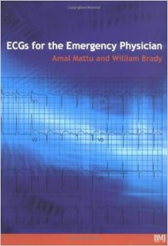 ECG's for the Emergency Physician 1: 9780727916549: Medicine & Health ...