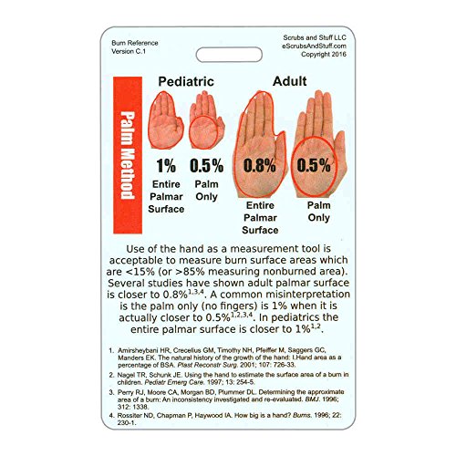 Rule of 9's & Palm Method Burn Chart Vertical Badge Reference - Want It All