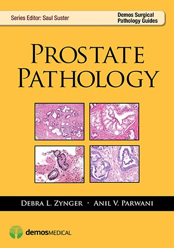 Pathology Outlines - Prostate gland and seminal vesicles