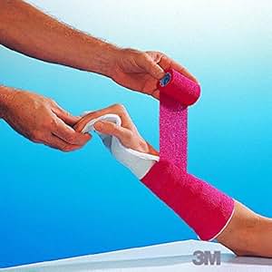 Amazon.com: 3M SCOTCHCAST ONE STEP SPLINT One Step Splint, 2" x 10", 10 ...