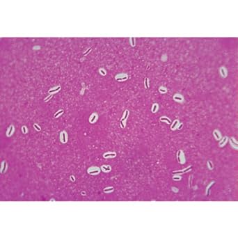 Amazon.com: Bacterial Capsules (flavobacterium capsulatum), w.m ...