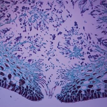 Fucus Male Conceptacle, section 12 um, Microscope Slide: Amazon.com ...