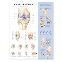 Where To Buy Washington: Knee Injuries Anatomical Chart Laminated