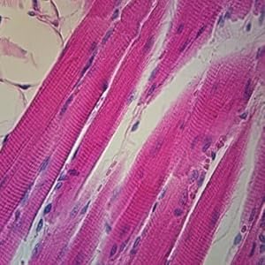 Skeletal Muscle Slide