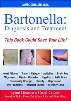 Bartonella: Diagnosis and Treatment (Dhivehi Edition): James Schaller ...