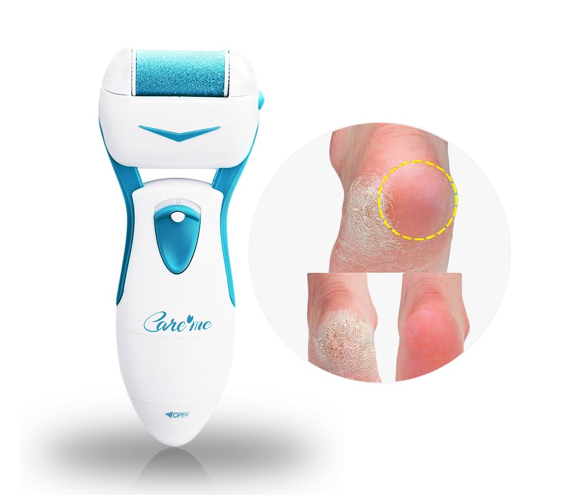 How To Heal Cracked Heels - Shop Solutions - Lila Finds