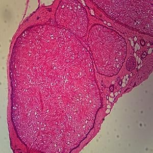 Peripheral Nerve Slide