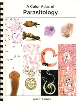 A Color Atlas of Parasitology: John T. Sullivan: 9780966580754: Amazon ...