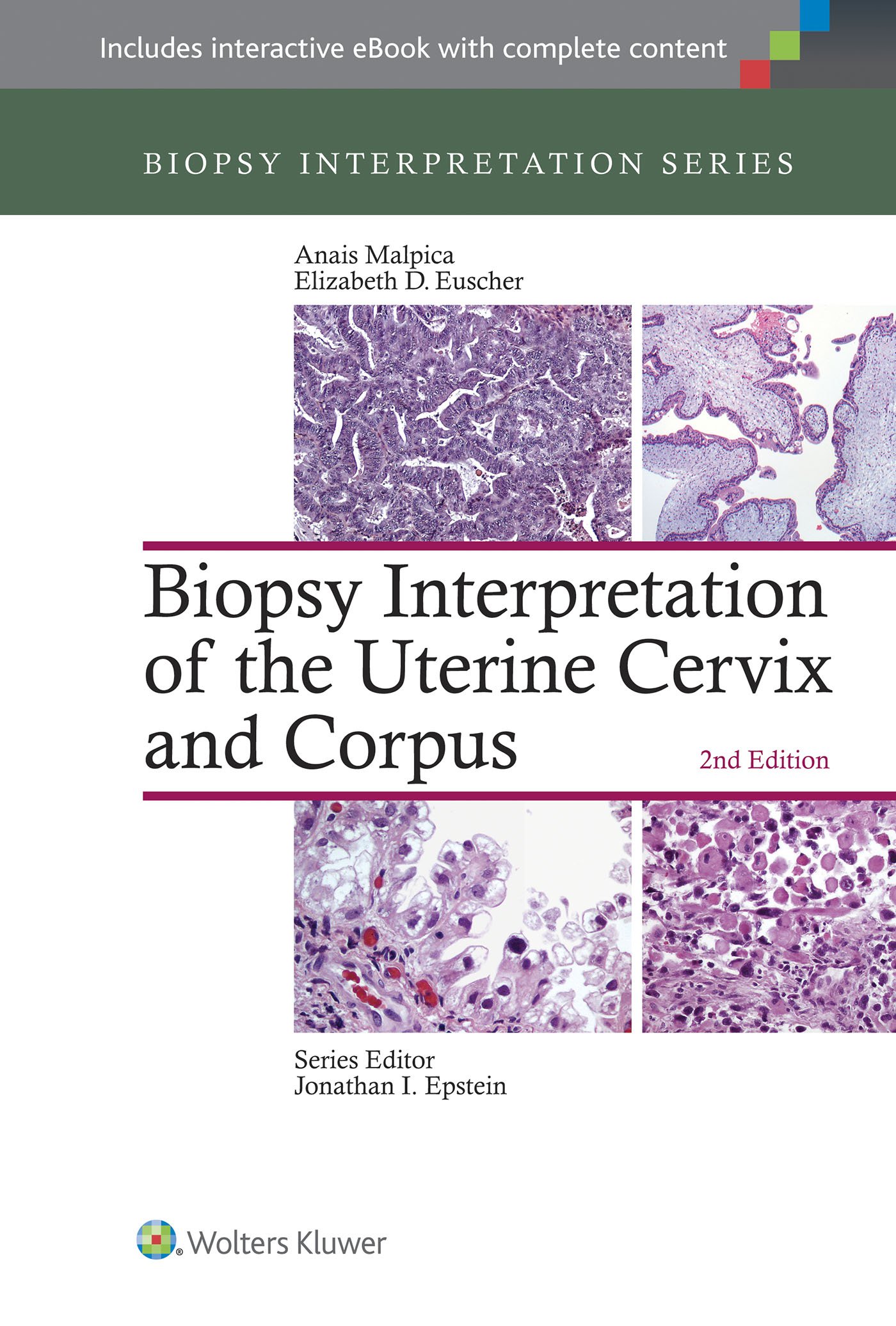 Pathology Outlines - Cervix